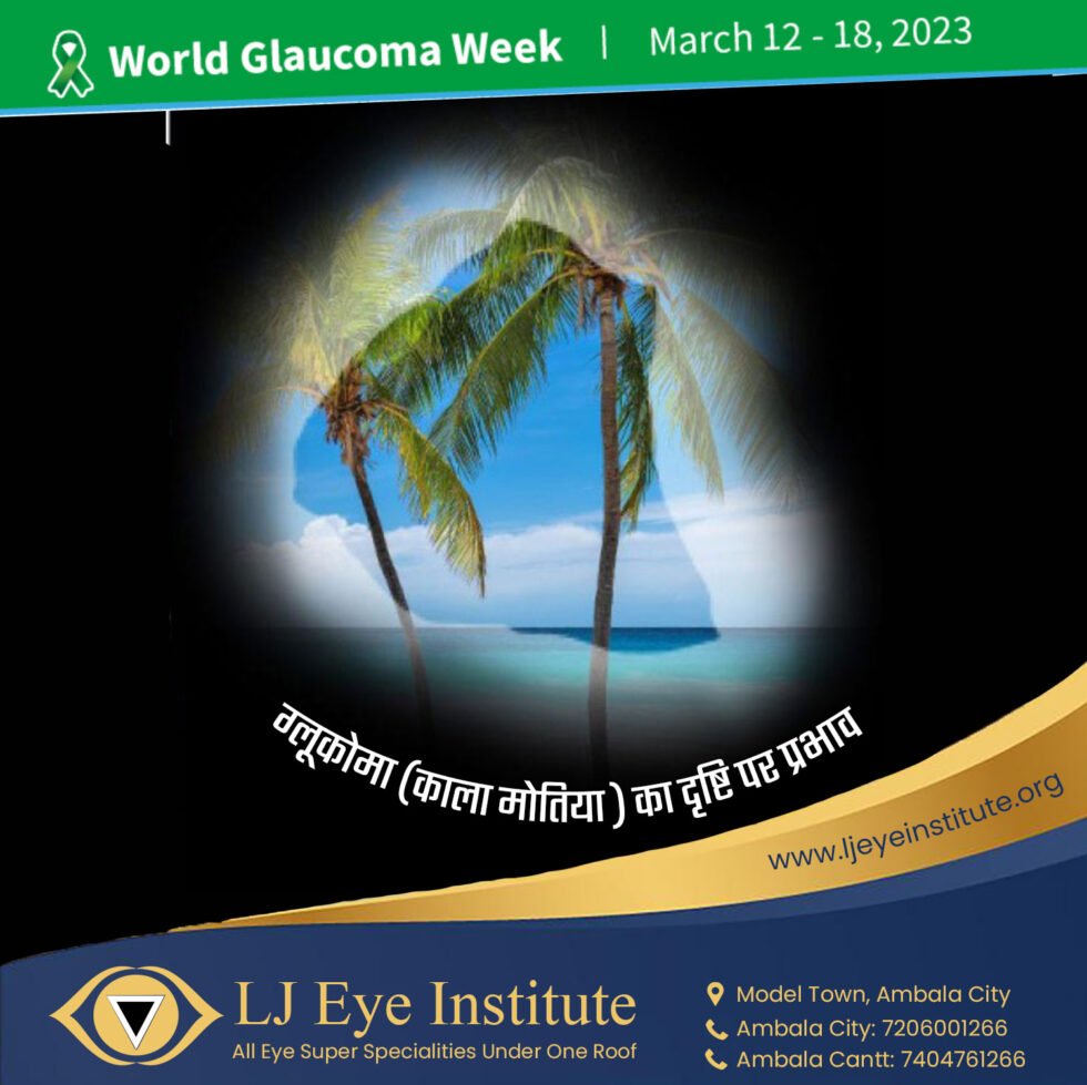 Trabeculectomy: A Surgical Solution for Glaucoma - LJ Eye Institute