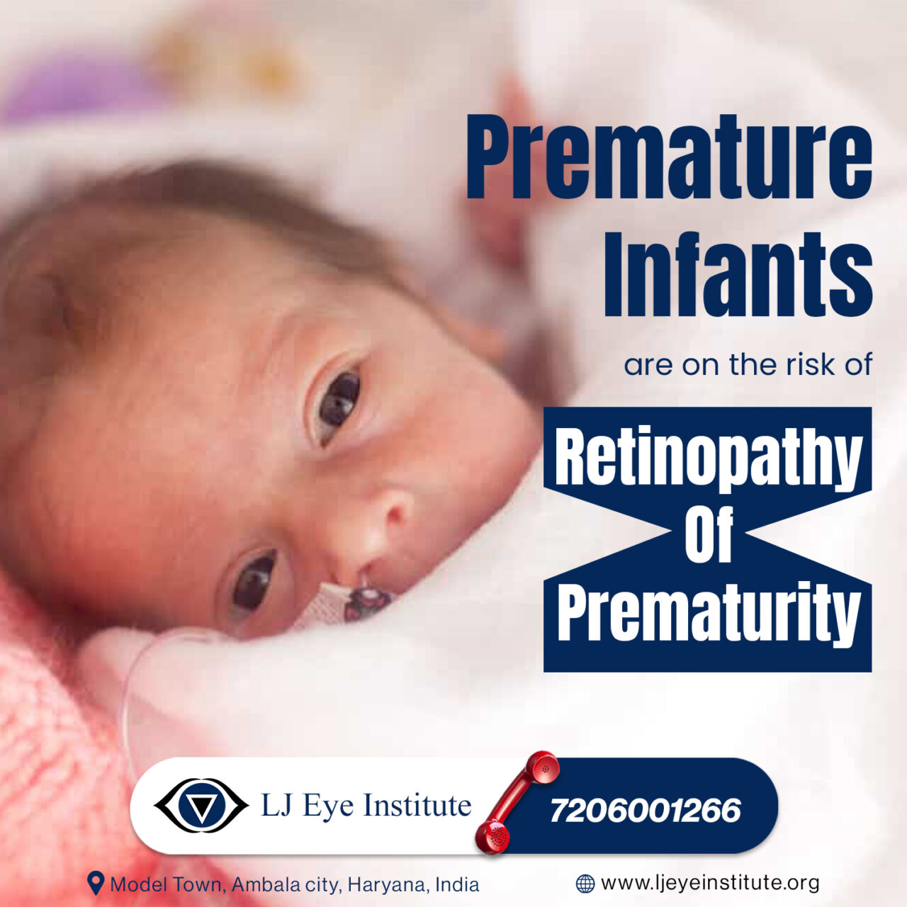 Retinopathy Of Prematurity - LJ Eye Institute