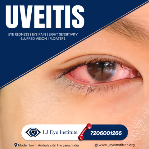 What is Uvea and Uveitis? - LJ Eye Institute