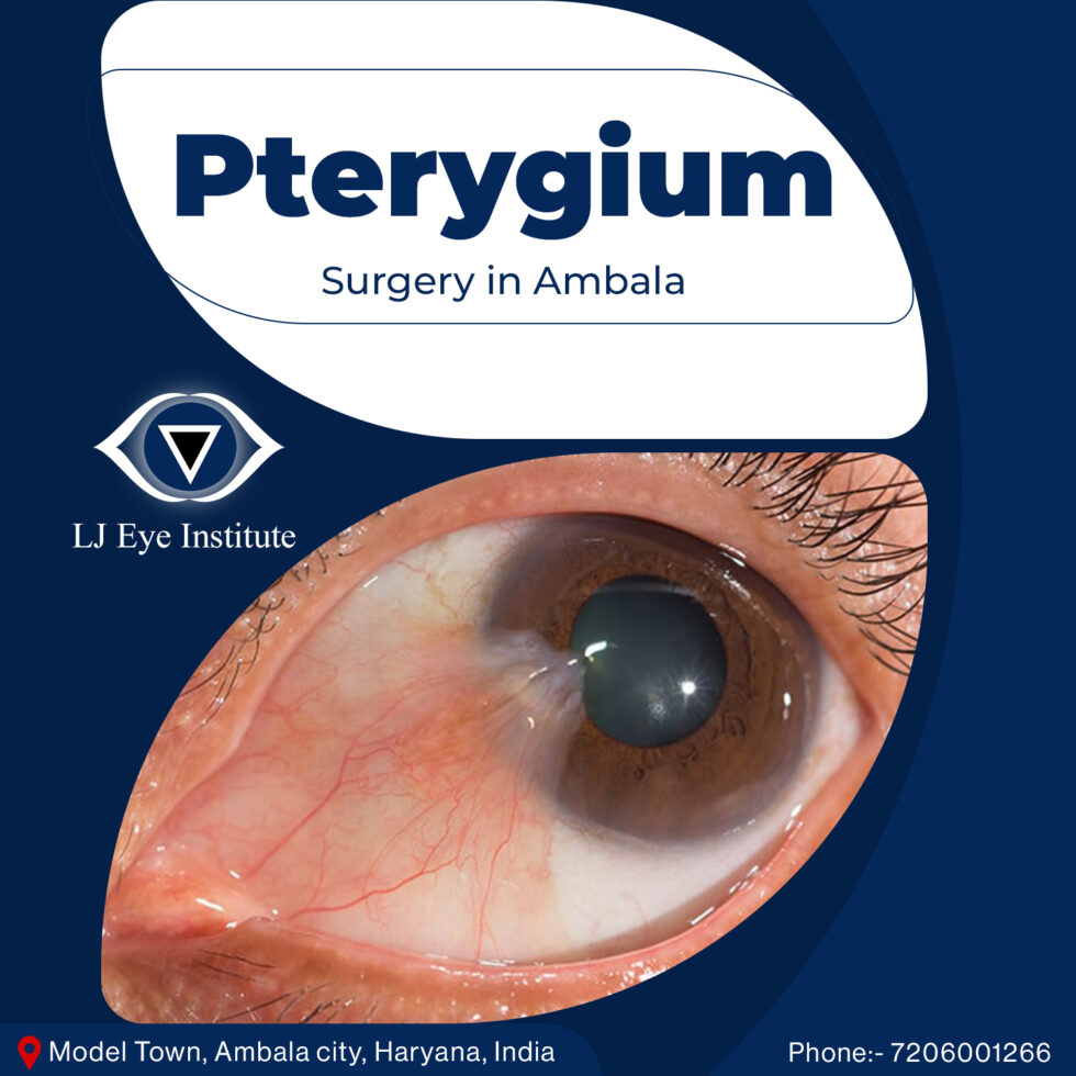 Pterygium Surgery - LJ Eye Institute