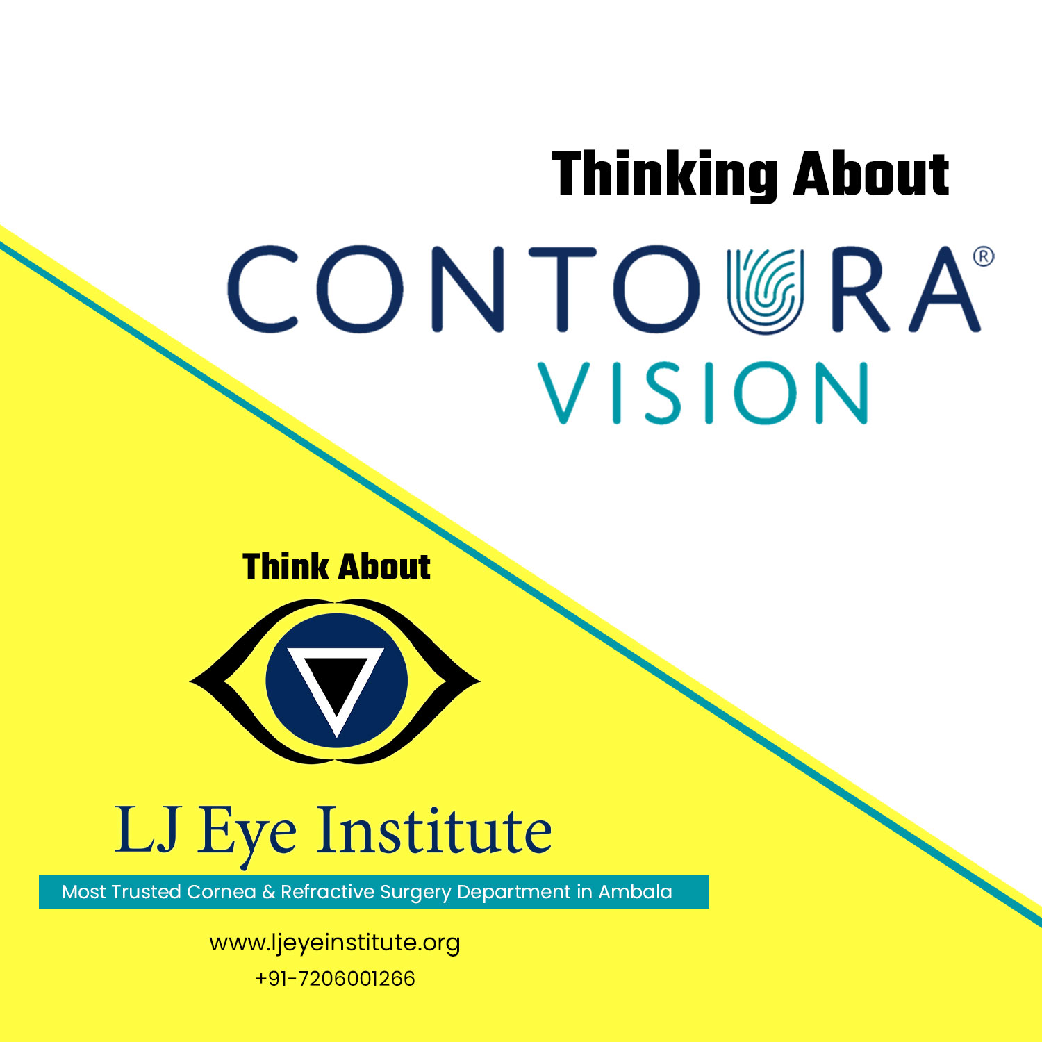 Best Contoura Vision Surgery in Ambala - LJ Eye Institute