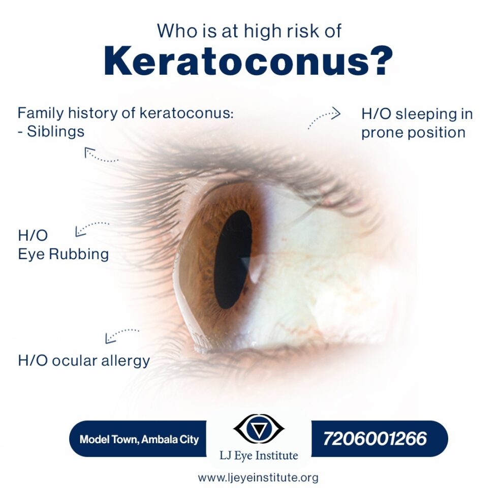 Keratoconus: Symptoms, Causes & Treatment - LJ Eye Institute