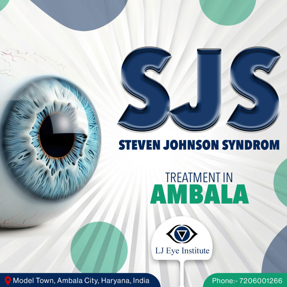 What is Steven Johnson Sydrome and How Does it Affect Eyes? - LJ Eye ...