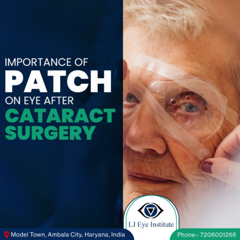 Importance of Patch on Eye After Cataract Surgery - LJ Eye Institute