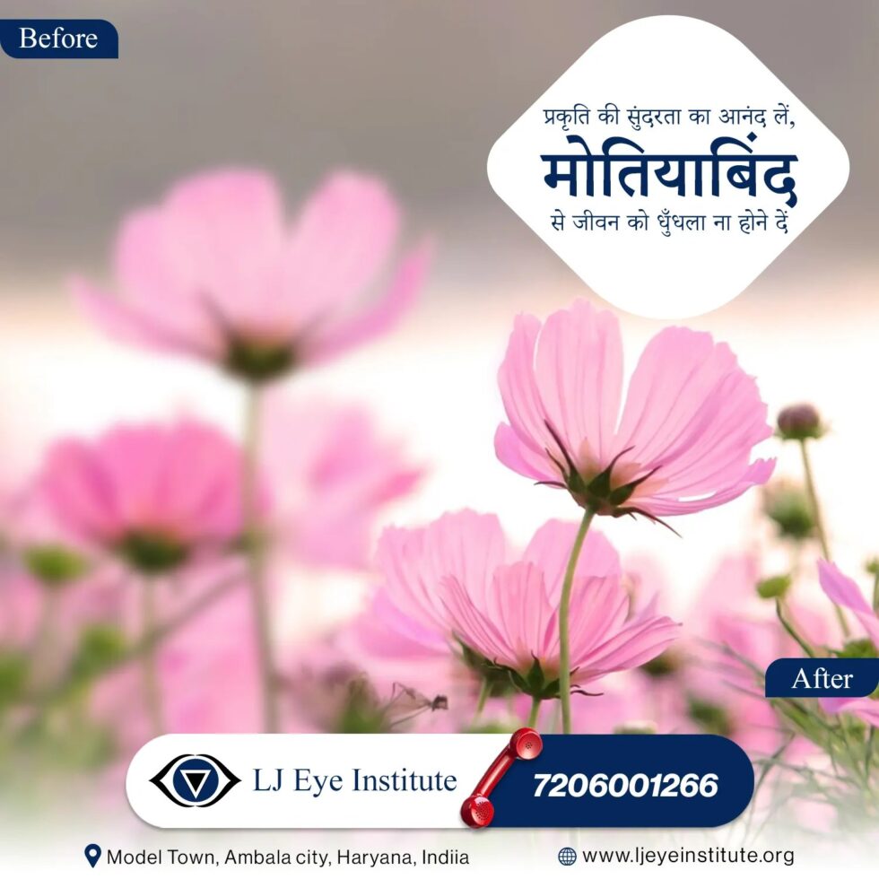 Post-Cataract Surgery Care: Essential Precautions for a Smooth Recovery ...